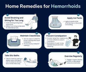 Hemorrhoids Home Remedies and OTC Treatments