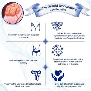 Uterine Fibroid Embolization Benefits