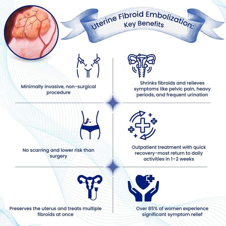 Uterine Fibroid Embolization Benefits